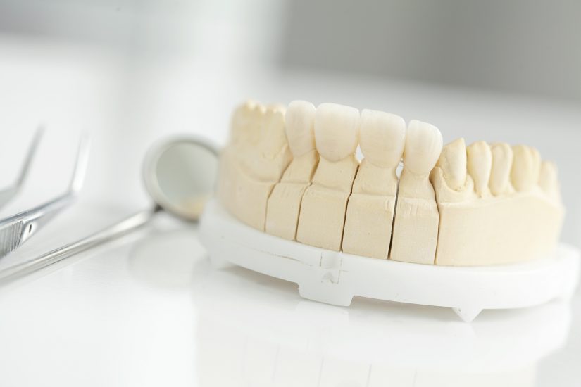 Prothetik (Zahnersatz) - Zahnarztpraxis Astrid Tiedemann